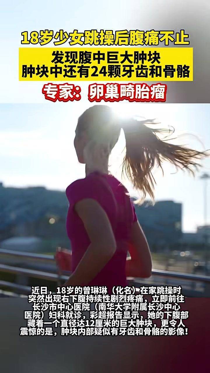 ...不止发现腹中巨大肿块,专家:畸胎瘤,肿块中还有24颗牙齿(潇湘晨报)