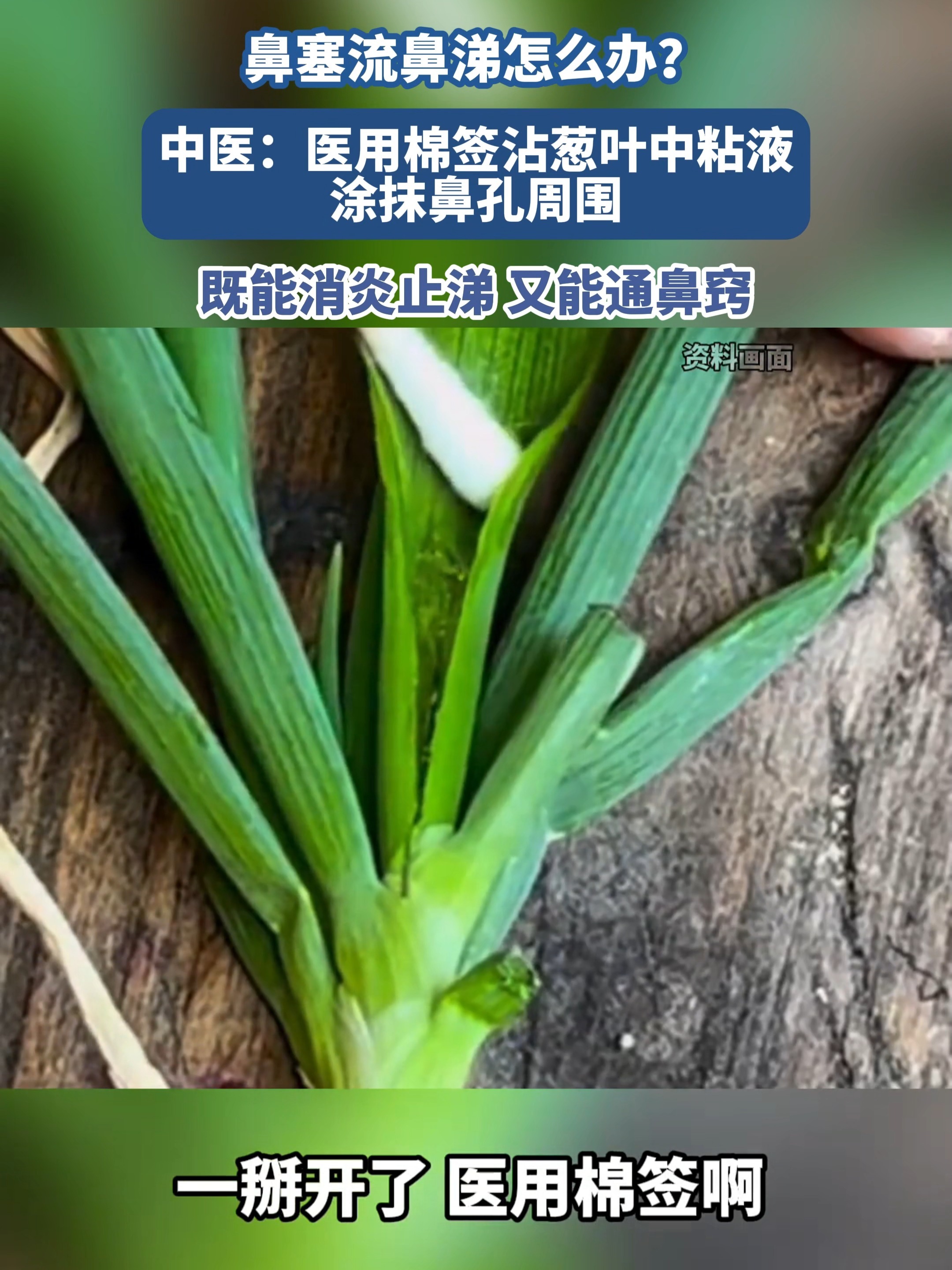 鼻塞流鼻涕怎么办?中医:医用棉签沾葱叶中粘液涂抹鼻孔周围