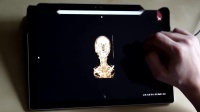 RadiAnt DICOM Viewer - Volume Rendering on Surface Pro 4