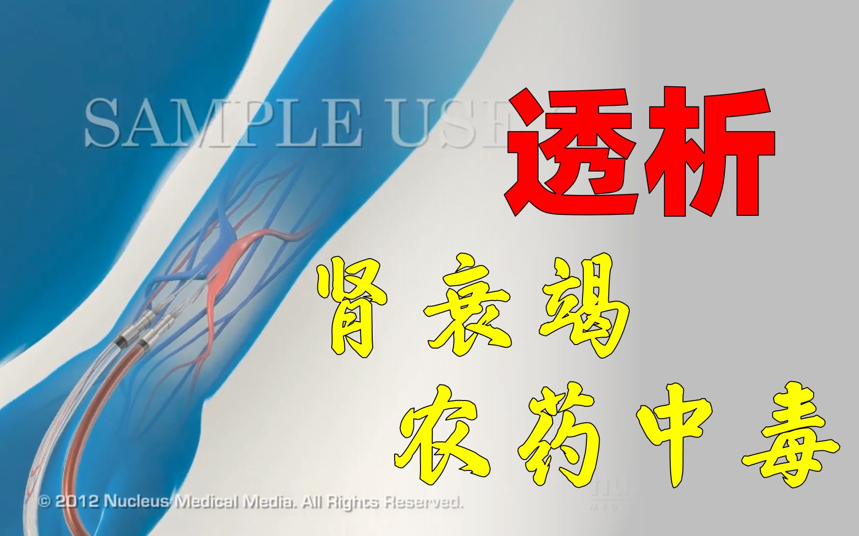 【3D医学动画】当一个人肾衰竭时,她是如何进行血液透析的(中英双...