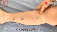 焦守廷上传董氏奇穴:三皇穴《滋阴补肾、下三皇三针齐下、》