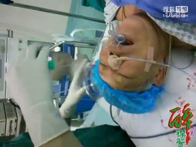 经喉罩行Aintree导管气管插管