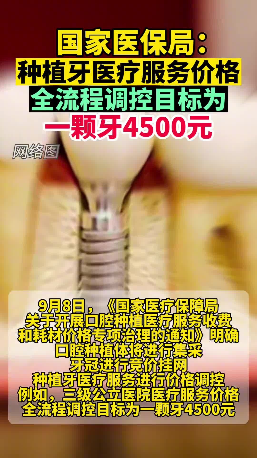 国家医保局:种植牙医疗服务价格全流程调控.
