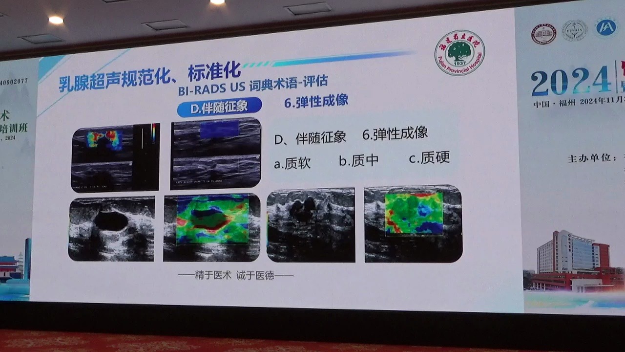 乳腺超声规范化与标准化