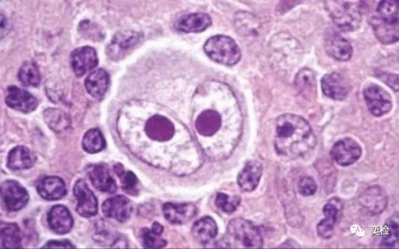...(含白血病免疫表型染色体及原癌基因抑癌基因归纳)笔记会放置顶...