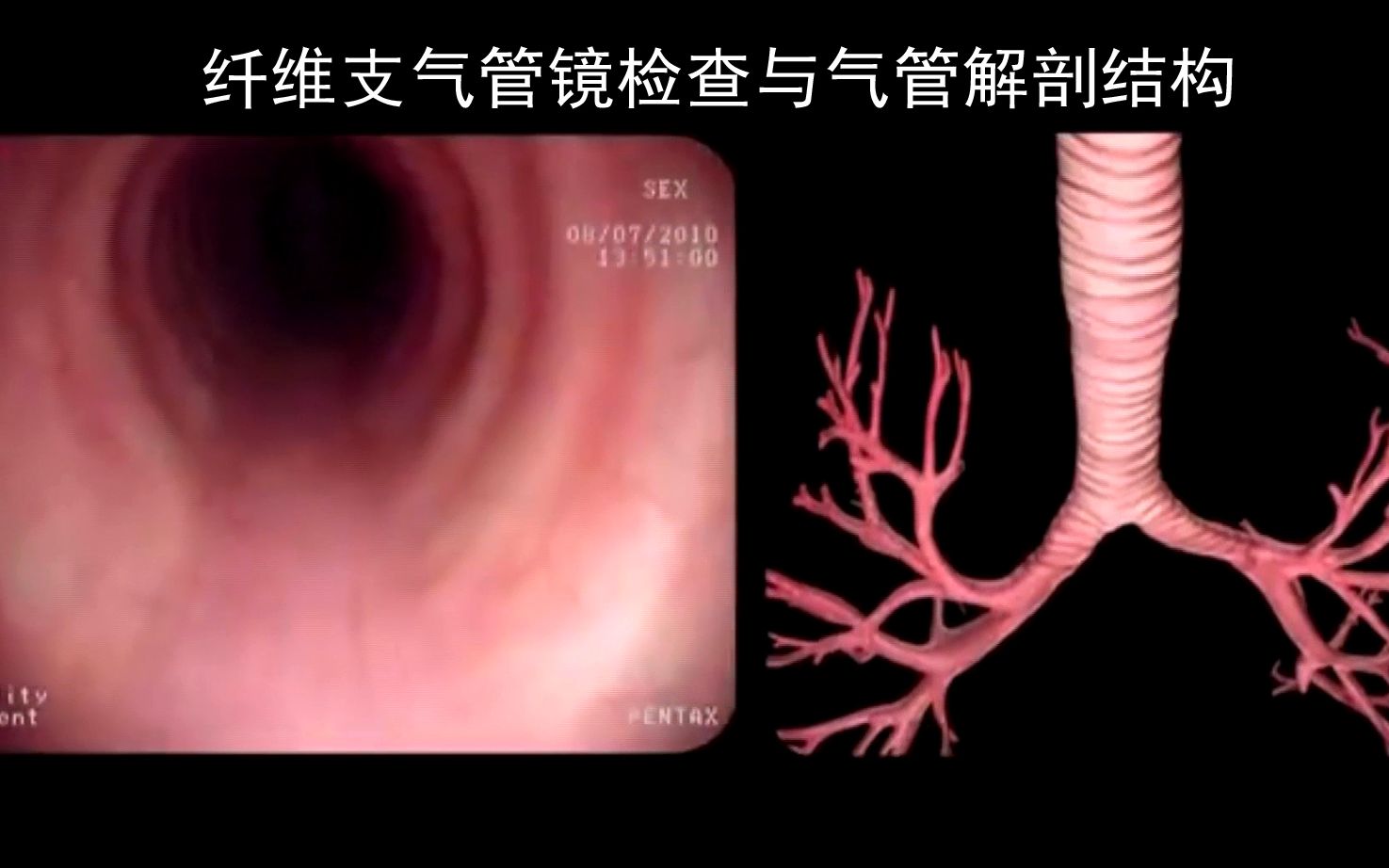 支气管镜检查与解剖