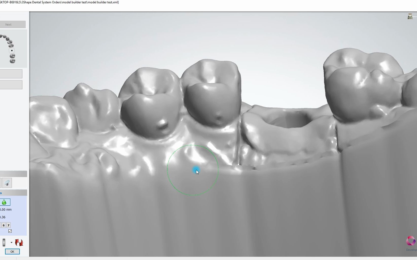 3Shape种植模型修剪1/2口