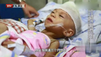 生命缘: 三岁半女童体重竟只有7公斤, 太令人心酸了, 不忍直视