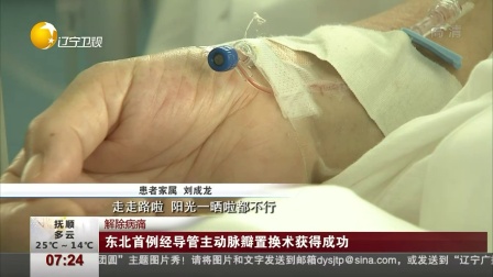 东北首例经导管主动脉瓣置换术获得成功 第一时间 20160914 高清版