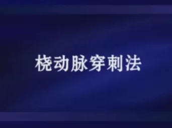 882桡动脉穿刺