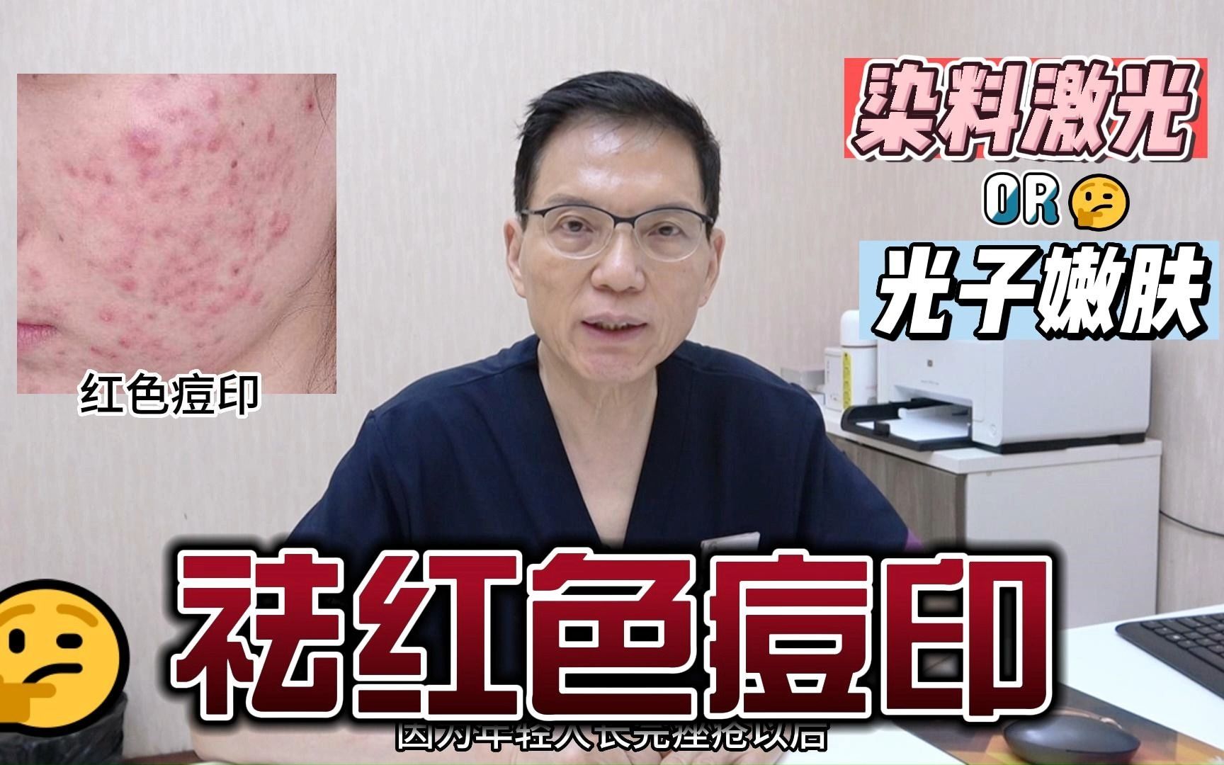 祛红色痘印,光子嫩肤和染料激光哪个好?