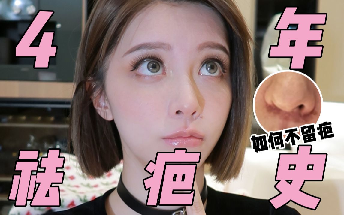 祛疤4年!如何有效祛疤?拒绝疤痕增生!