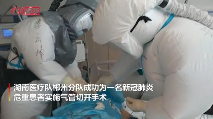 为新冠肺炎患者做气管切开手术 医护人员戴4层手套精准操刀