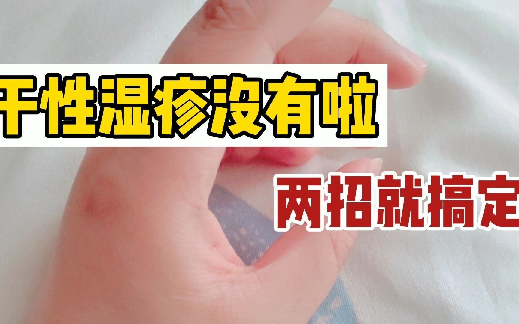 干性湿疹没有啦!两招就搞定!