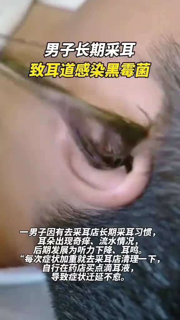 男子长期采耳致耳道感染黑霉菌