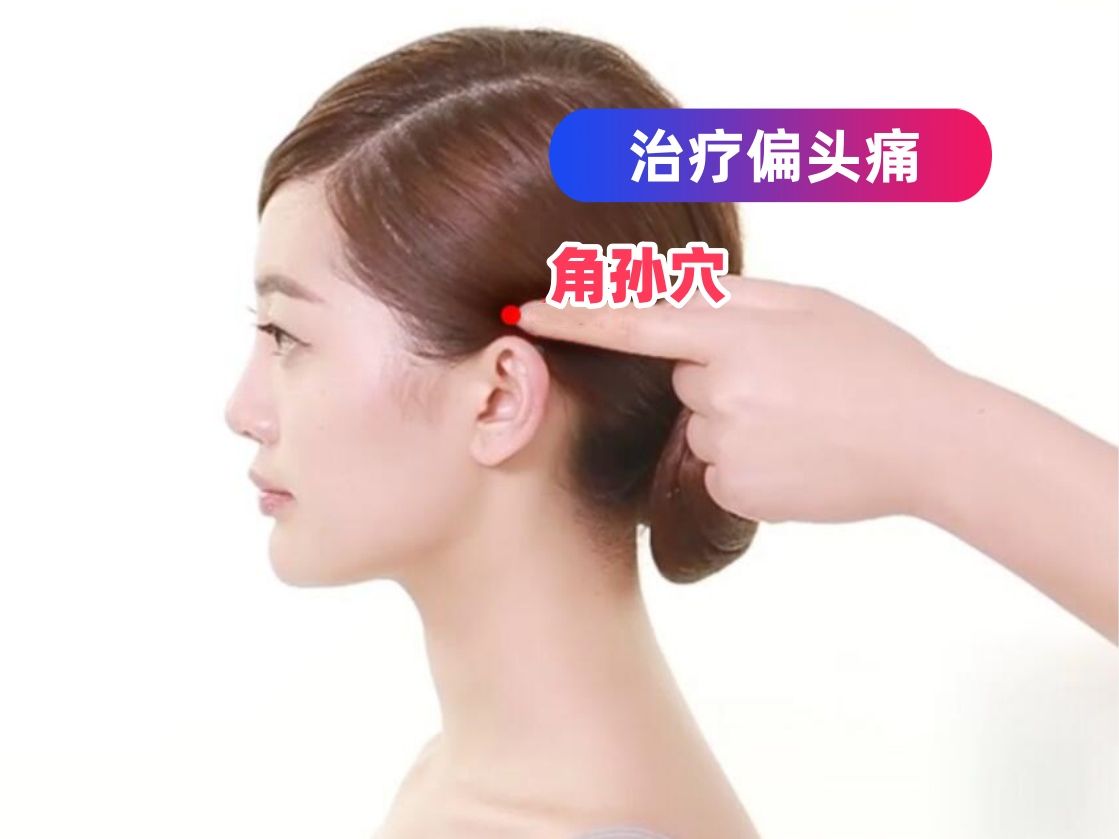 166、手少阳三焦经 — 角孙穴 — 治疗偏头痛
