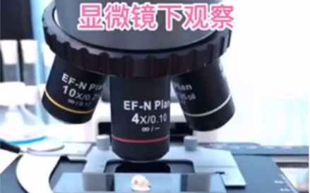 显微镜下看蛀牙是什么样?