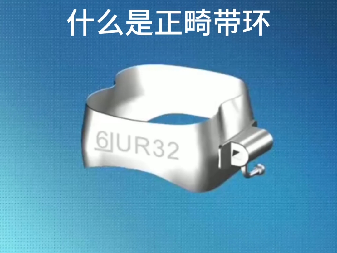 什么是牙齿正畸带环?