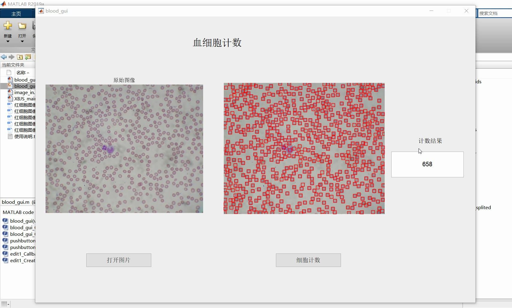 T11.基于MATLAB的生物血细胞数目统计(程序+word报告)