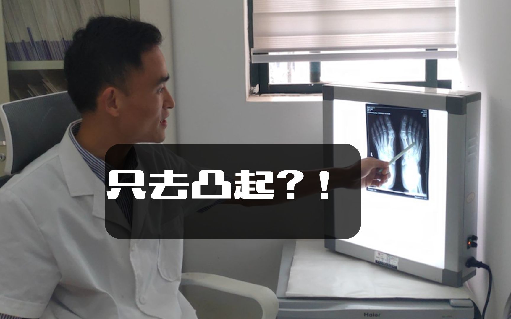 为何有些拇外翻手术会复发?单纯去掉凸起就可以矫正大脚骨吗?看完...