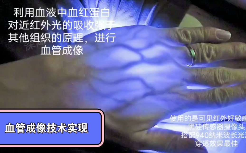 深湖科普:低成本血管成像