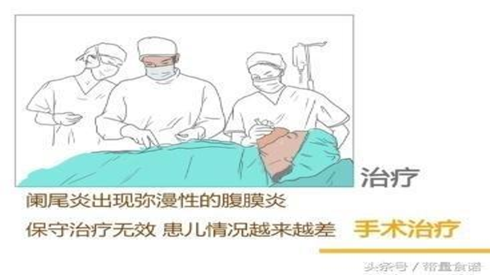 appendix n.附录,附属物;阑尾,盲肠考研单词托福雅思GMAT四级六级...