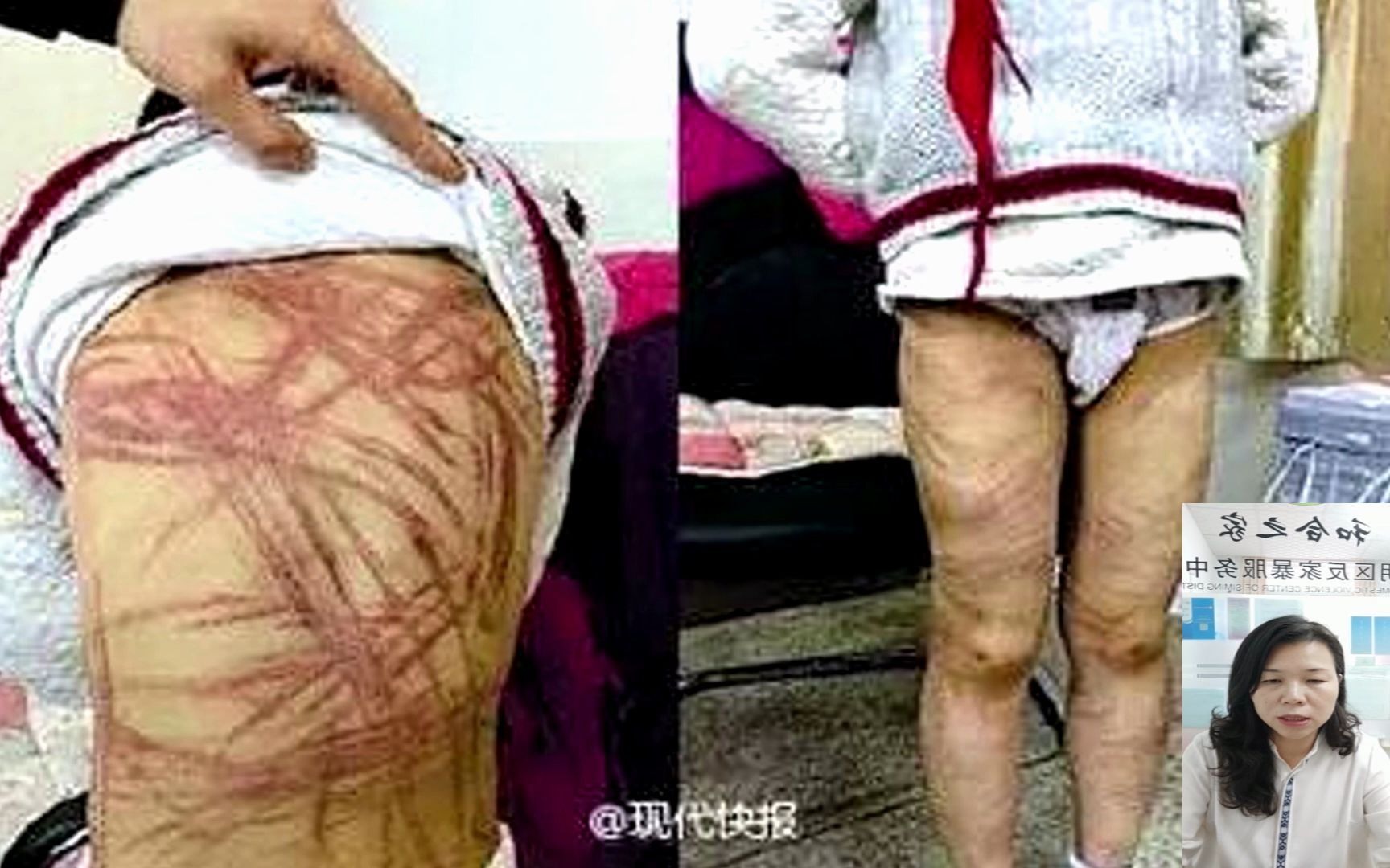 第二场:家暴不是家务事,反家暴法专题知识学习及实务提升培训 - 卢...