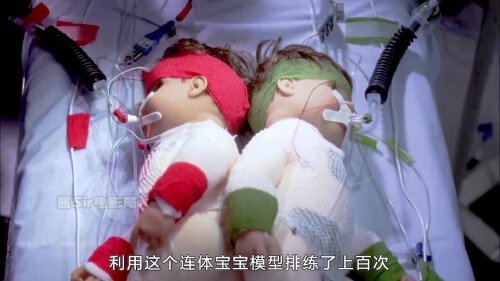 为了让连体婴儿分开,医生团队用洋娃娃模拟了几十次的手术实验