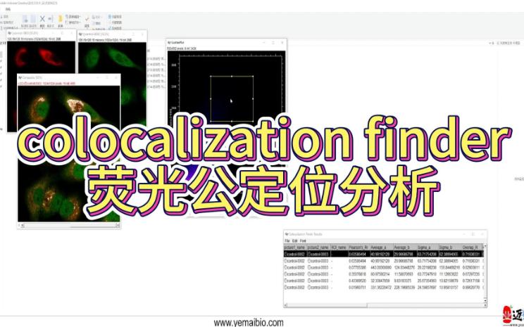 用imageJ共定位分析,colocalizationfinder荧光共定位分析