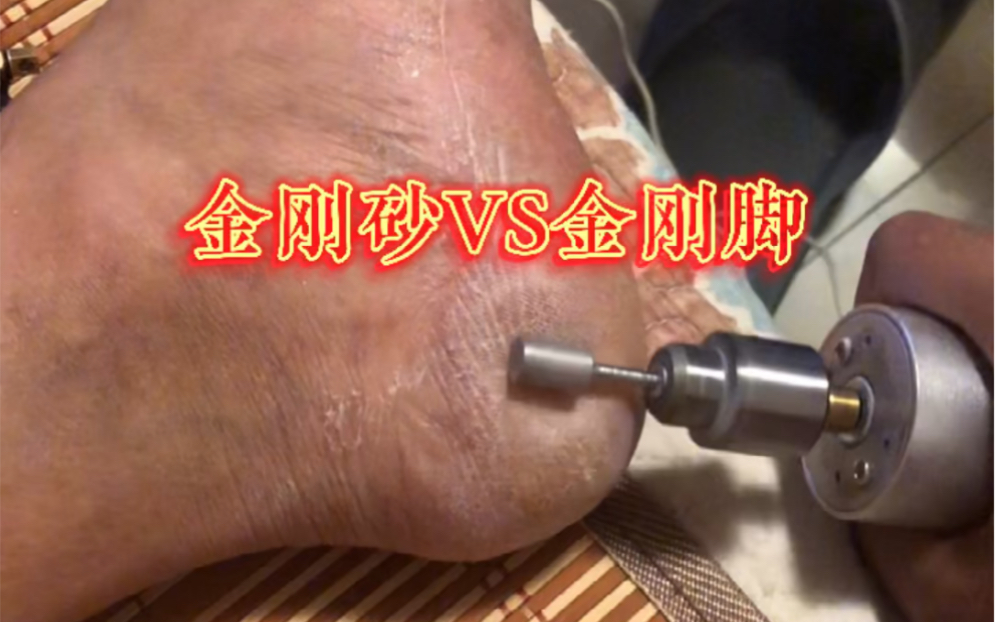 只有金刚砂磨头才能对付得了老夫的金刚脚ヾﾉ≧∀≦)o
