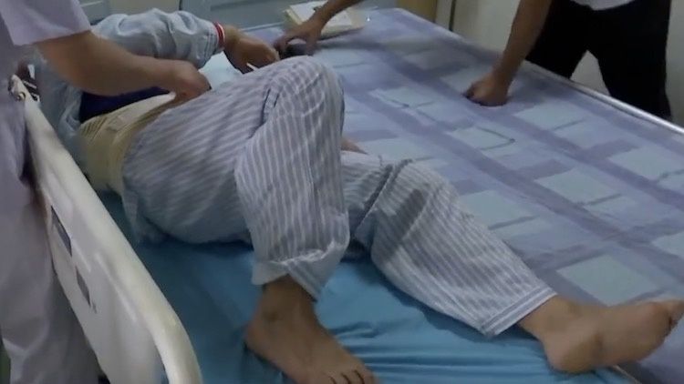 公交车上因司机急刹意外摔伤,“私了”后病情加重,还能反悔吗?