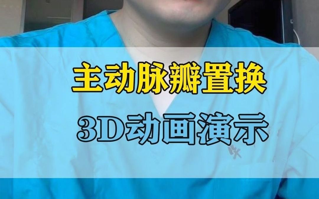 动漫演示主动脉瓣置换术