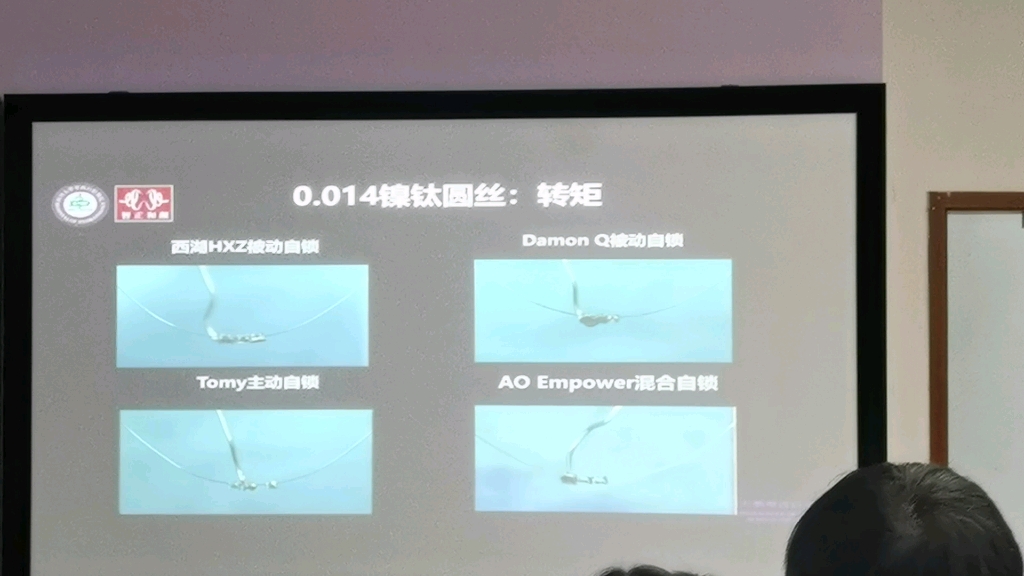 主动自锁托槽和被动自锁托槽对扭矩控制的差别