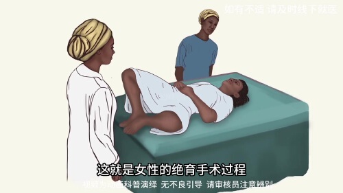 3D画面展示女性输卵管结扎手术全过程输卵管结扎结扎