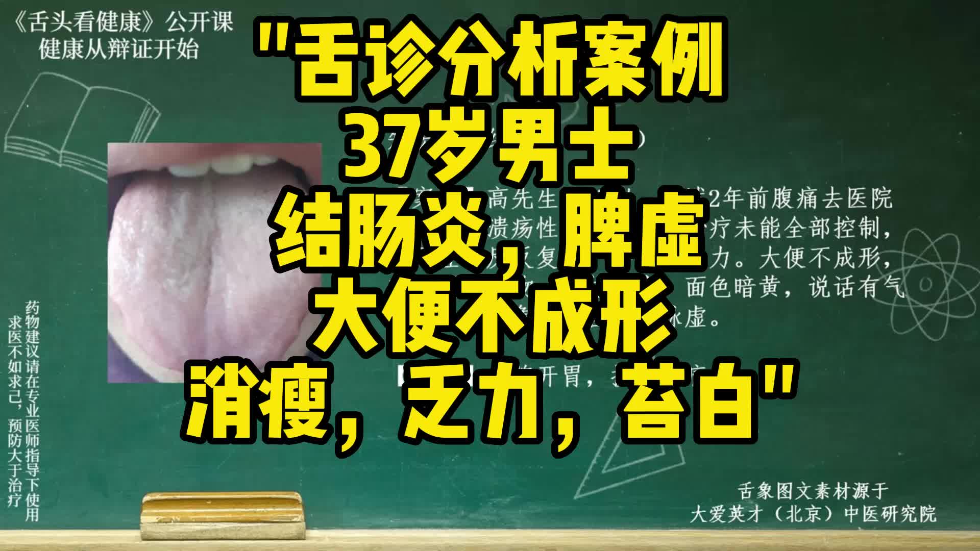 舌诊分析案例:37岁男士,结肠炎,脾虚,大便不成形,消瘦,乏力