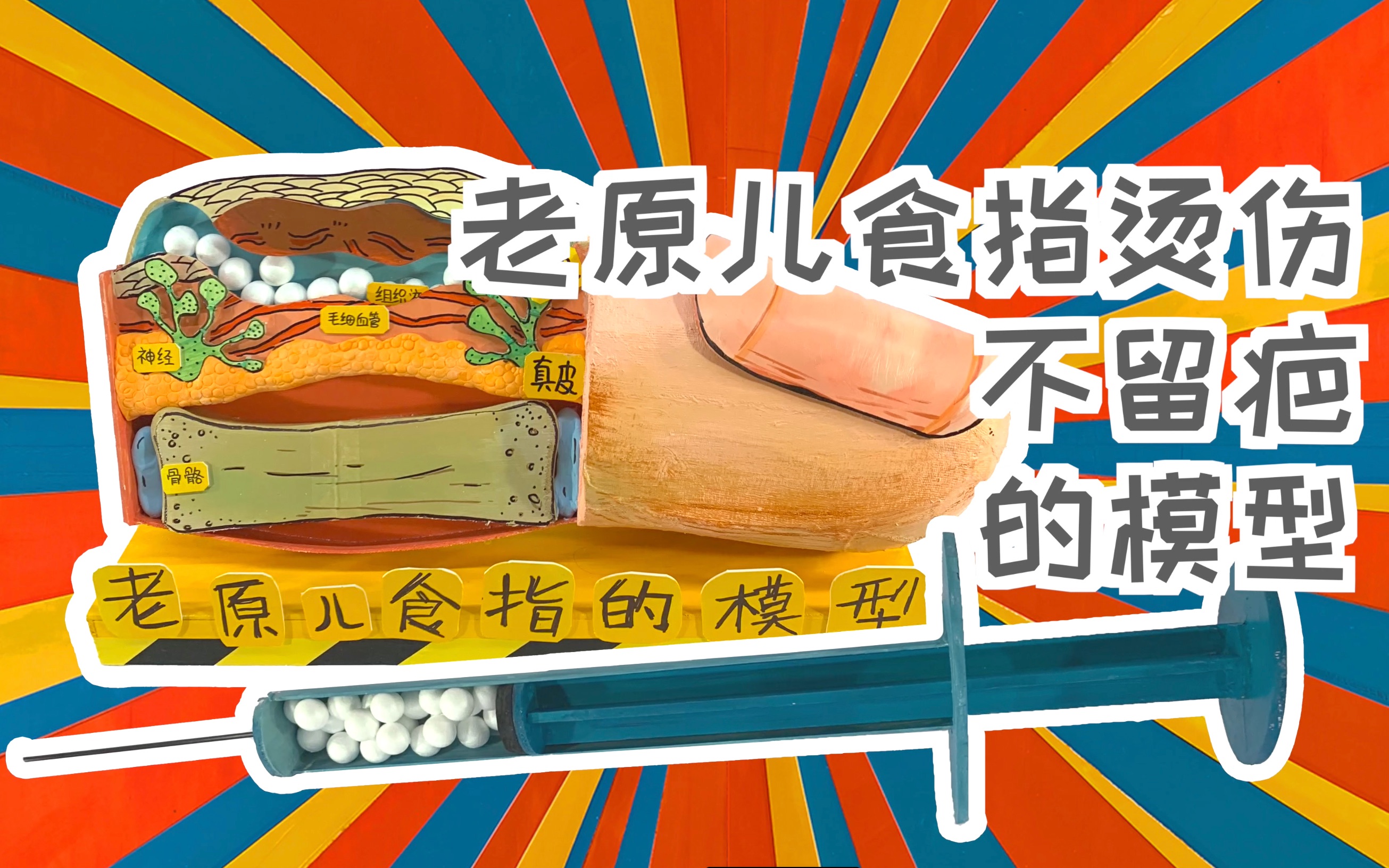 【模型师老原儿】烫伤后起水泡到底要不要挑破?怎么做才能不留疤?(...