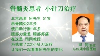 ...的“重生”之路,北京红旗医院司同教授两次康复治疗助其摆脱助行器
