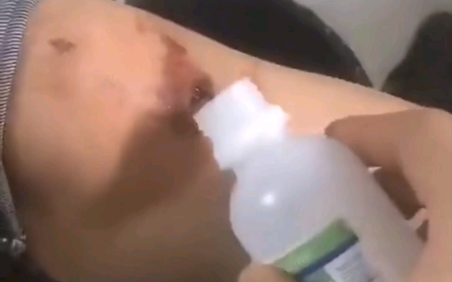 双氧水洗伤口,这酸爽!