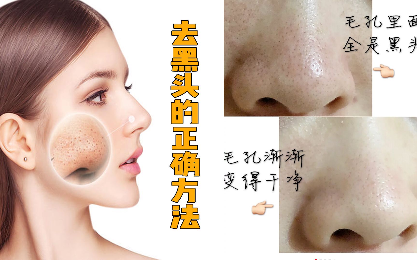 自己如何有效去黑头,几个正确去黑头方法,学起来吧
