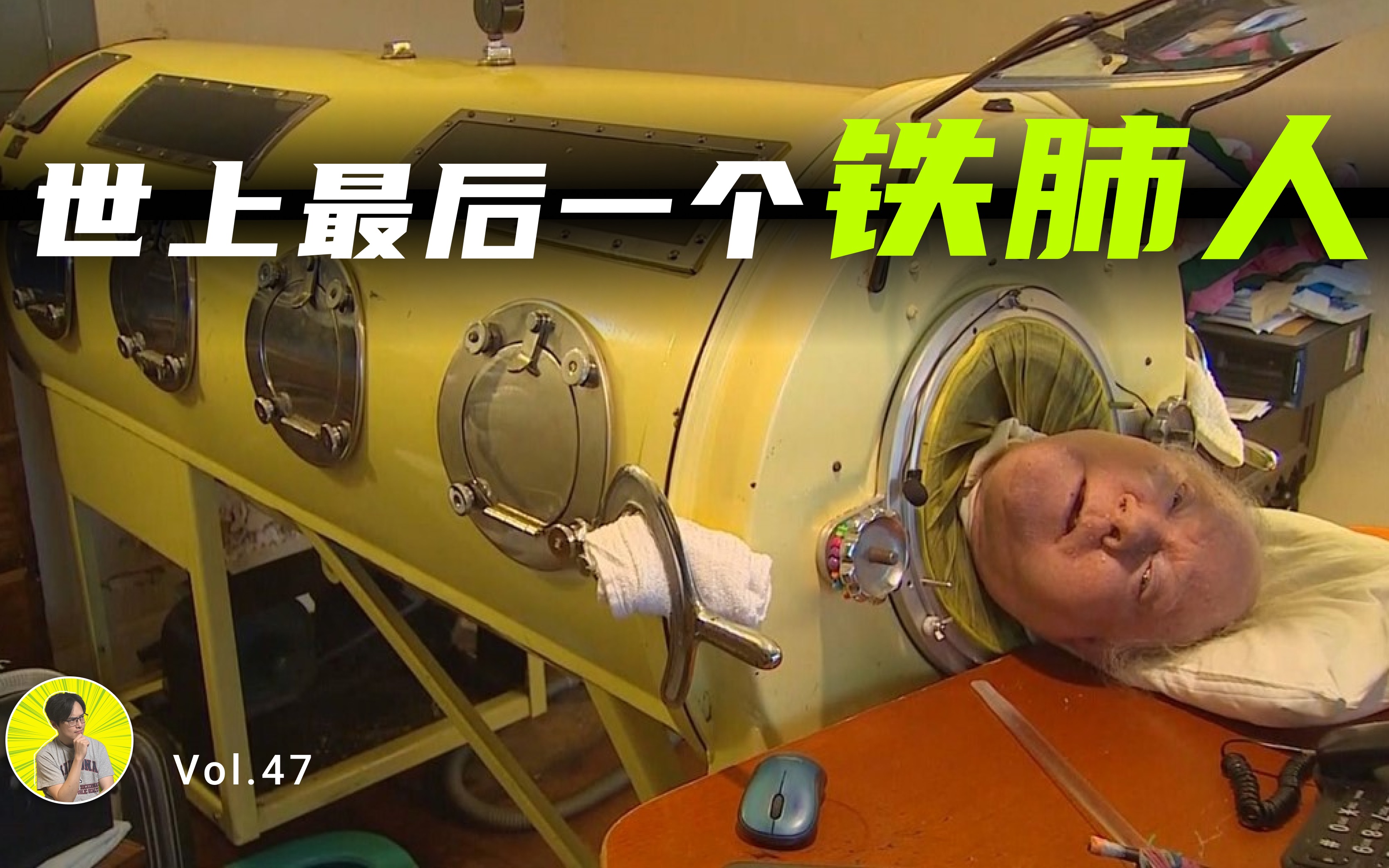 “铁皮棺材”内生活69年,世界上最后一个“铁肺”人