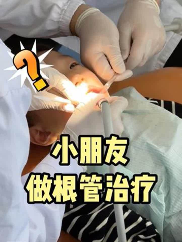 给小盆友做根管治疗 #硬核健康科普行动 #根管治疗