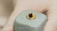 你知道什么是根管治疗吗?