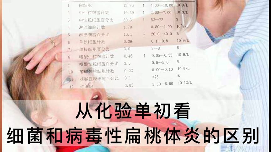 从化验单初看细菌和病毒性扁桃体炎的区别