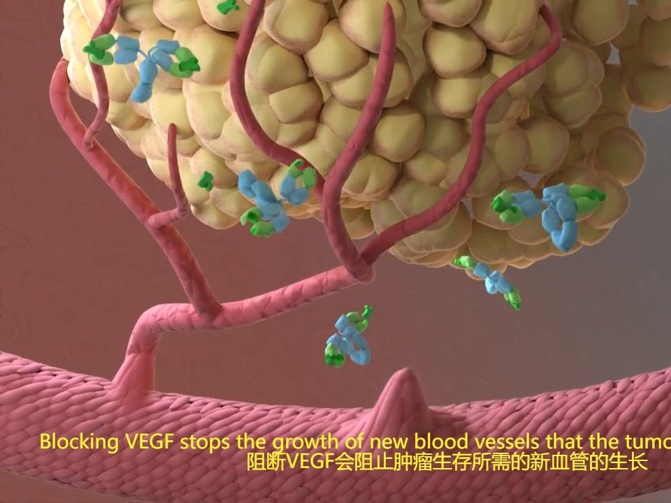 单克隆抗体如何治疗癌症