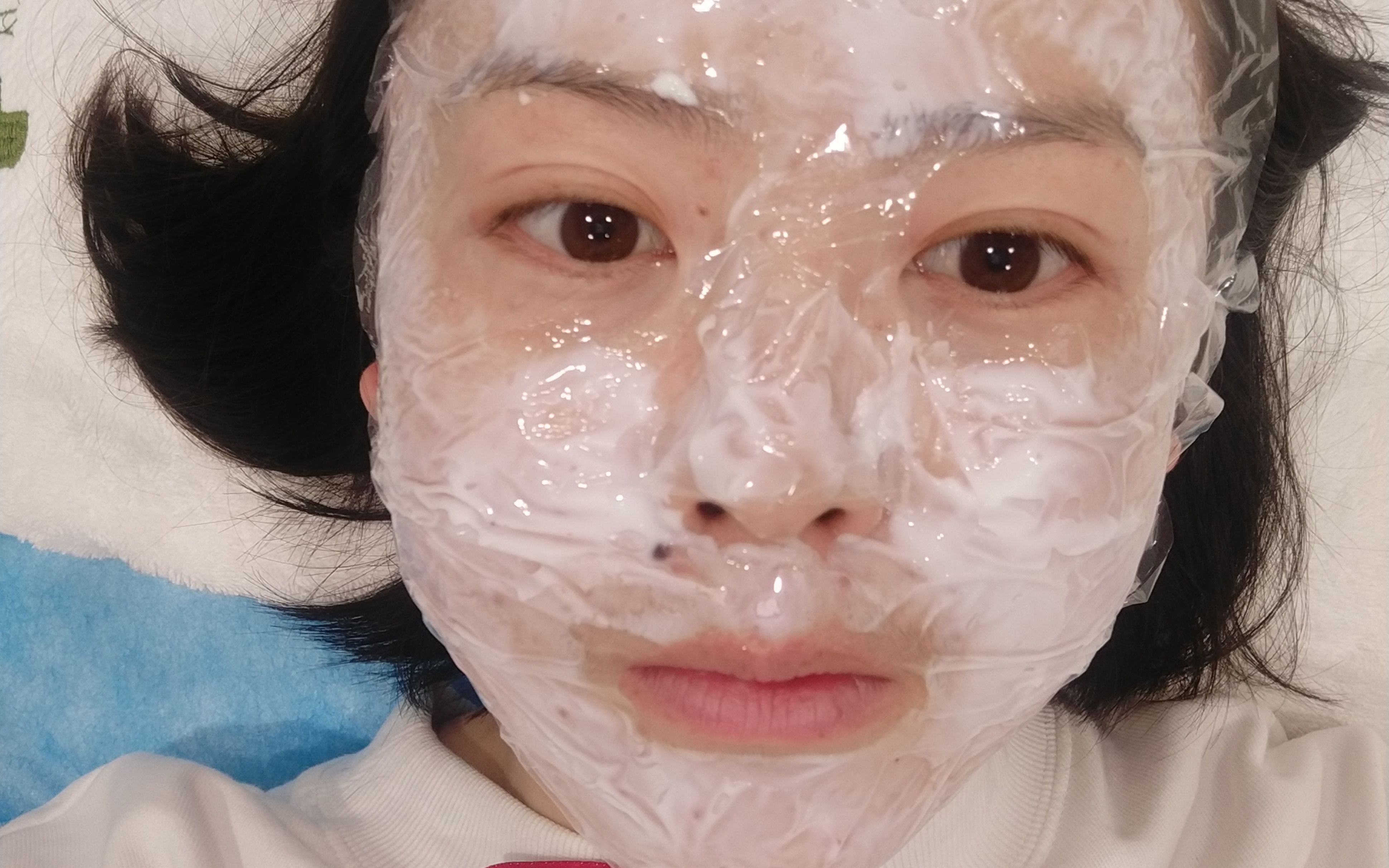 四次微针经历,我的脸现在怎么样了