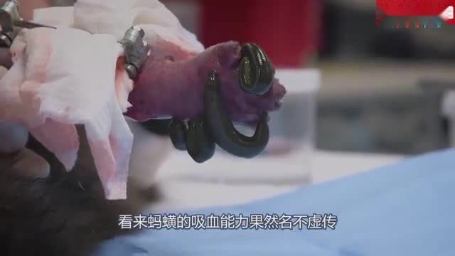 小猫爪子中毒发紫-_医生用水蛭把毒血吸出-_网友 _看着都疼!