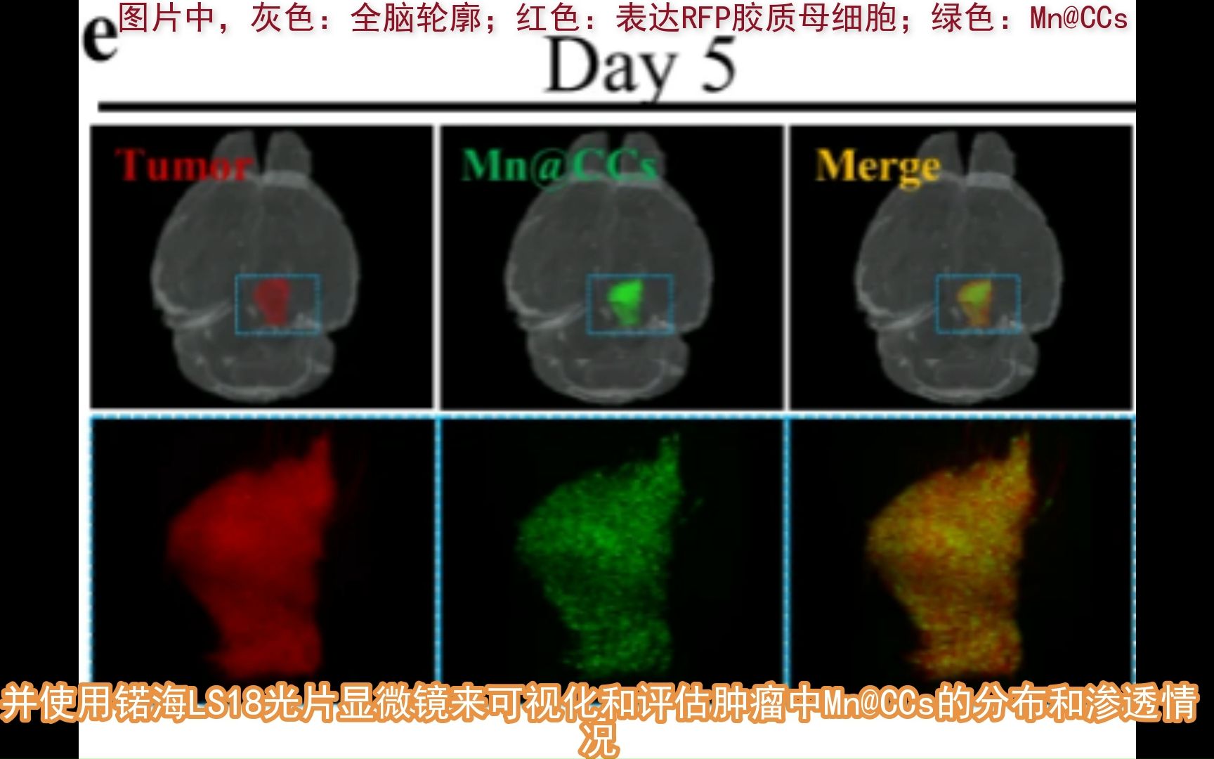 组织透明化与三维成像技术应用案例-助力开发新型MRI造影剂用于原位...