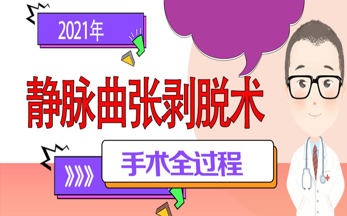 医生静脉曲张剥脱术全过程动画模拟演示【动画科普】