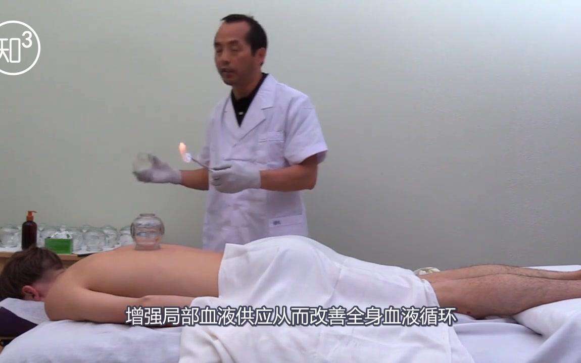 拔罐到底对身体有啥用呢?真的可以“排毒”吗?老中医为您解答