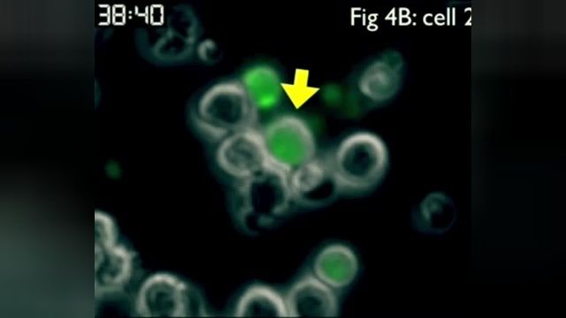高倍显微镜下,看HIV病毒是如何在血液中传染的
